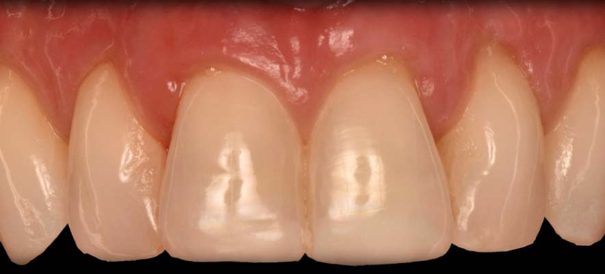Smile Gallery - Dental Arts of Westwood